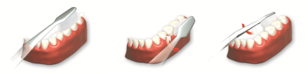 Die beste Zahnputztechnik - Ihr Zahnarzt Würzburg - Dr. Treiber